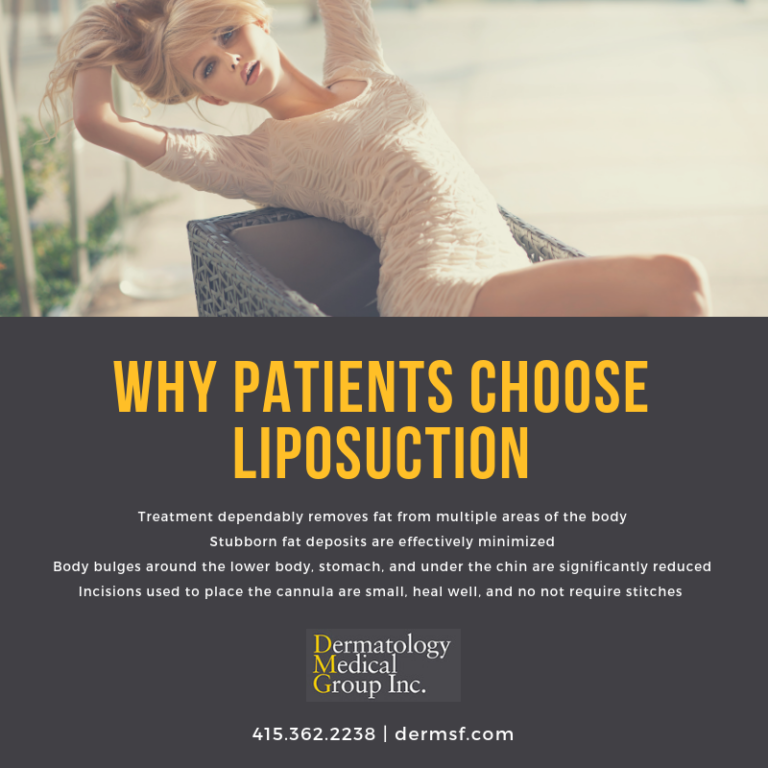 Why Patients Choose Liposuction - DMGSF